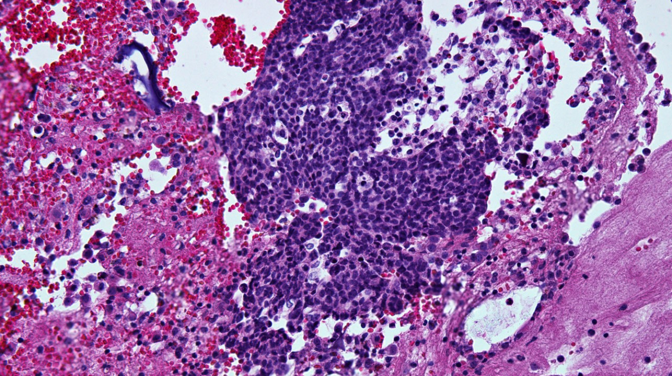 Zytologie - MVZ Pathologie Viersen
